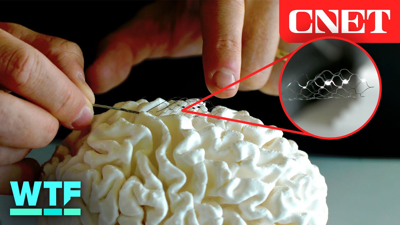 CNET: Brain-Computer Interface, No Open Brain Surgery Required 🧠 ...